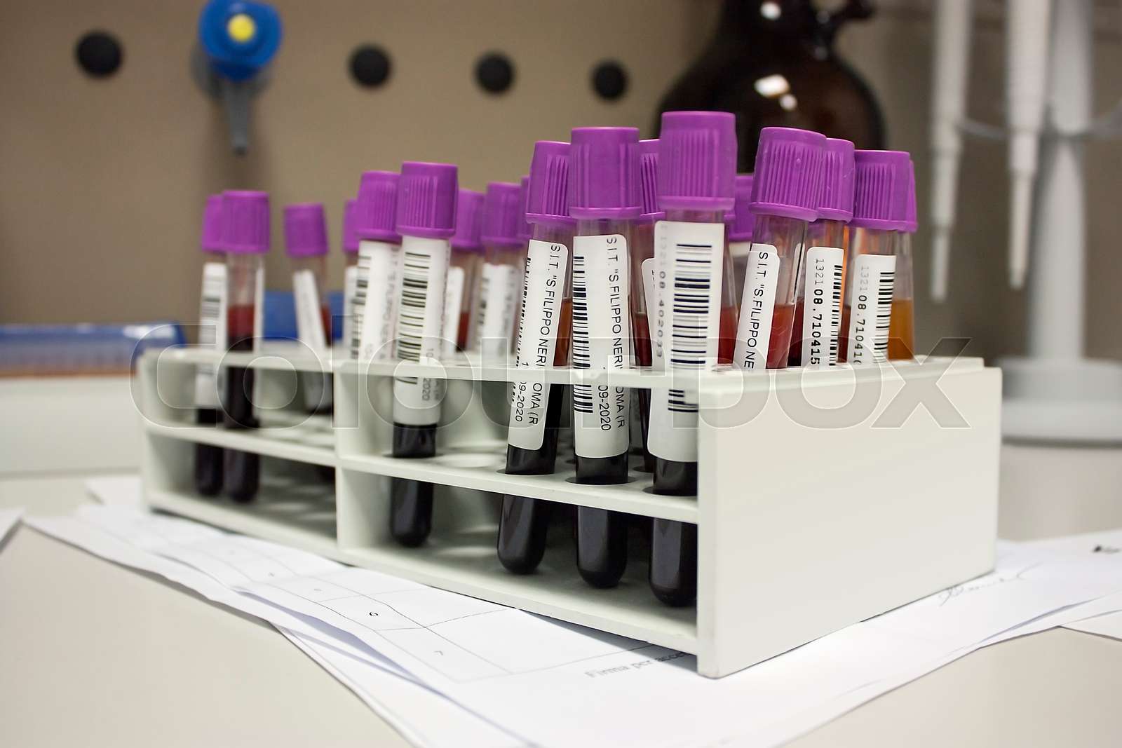 Rack with test tubes of blood | Stock image | Colourbox
