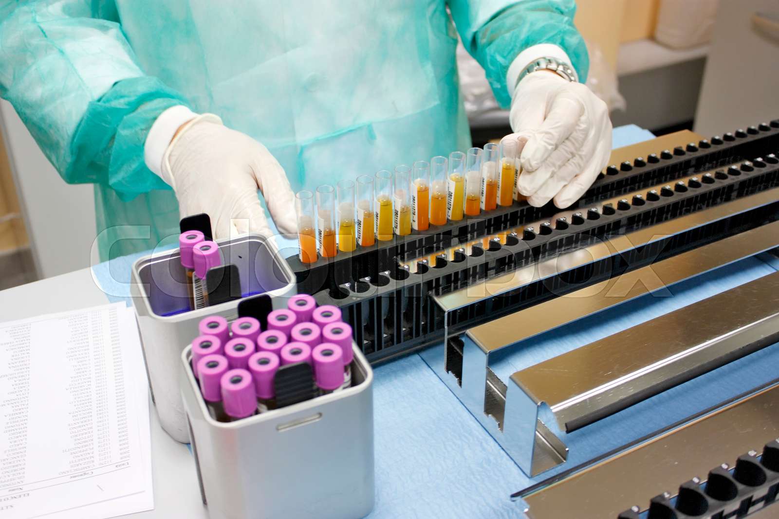Rack with test tubes of blood | Stock image | Colourbox