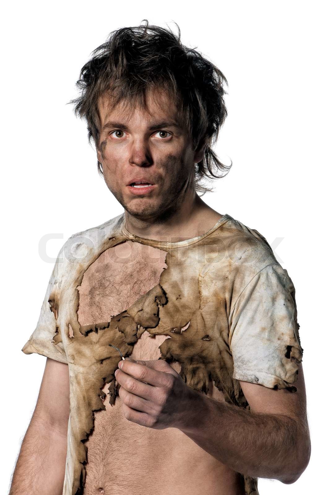 Burnt man | Stock image | Colourbox