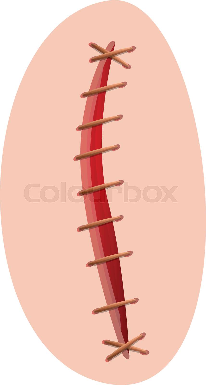 Suture icon, cartoon style | Stock vector | Colourbox