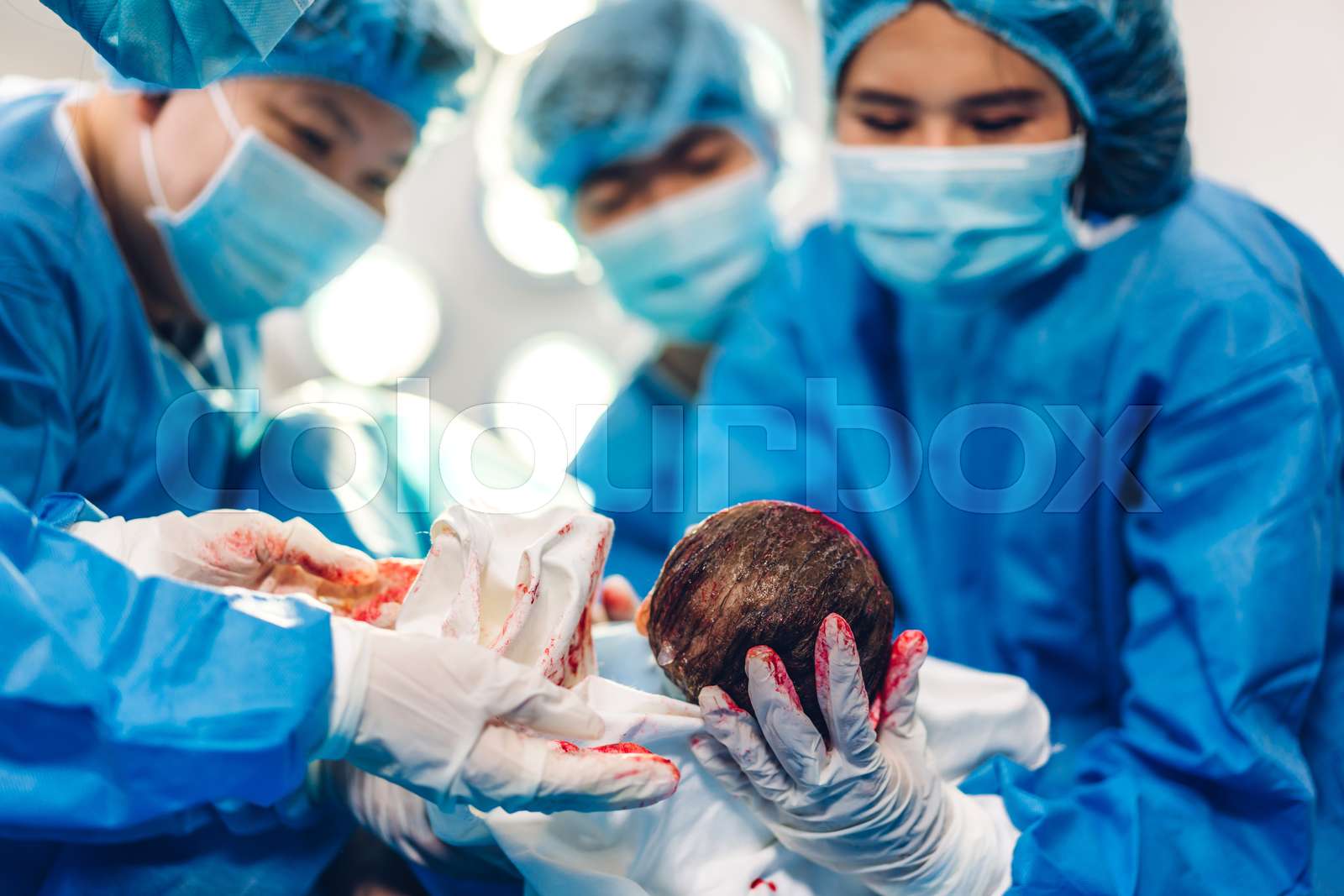 Professional anesthesiologist doctor medical team and assistant is ...