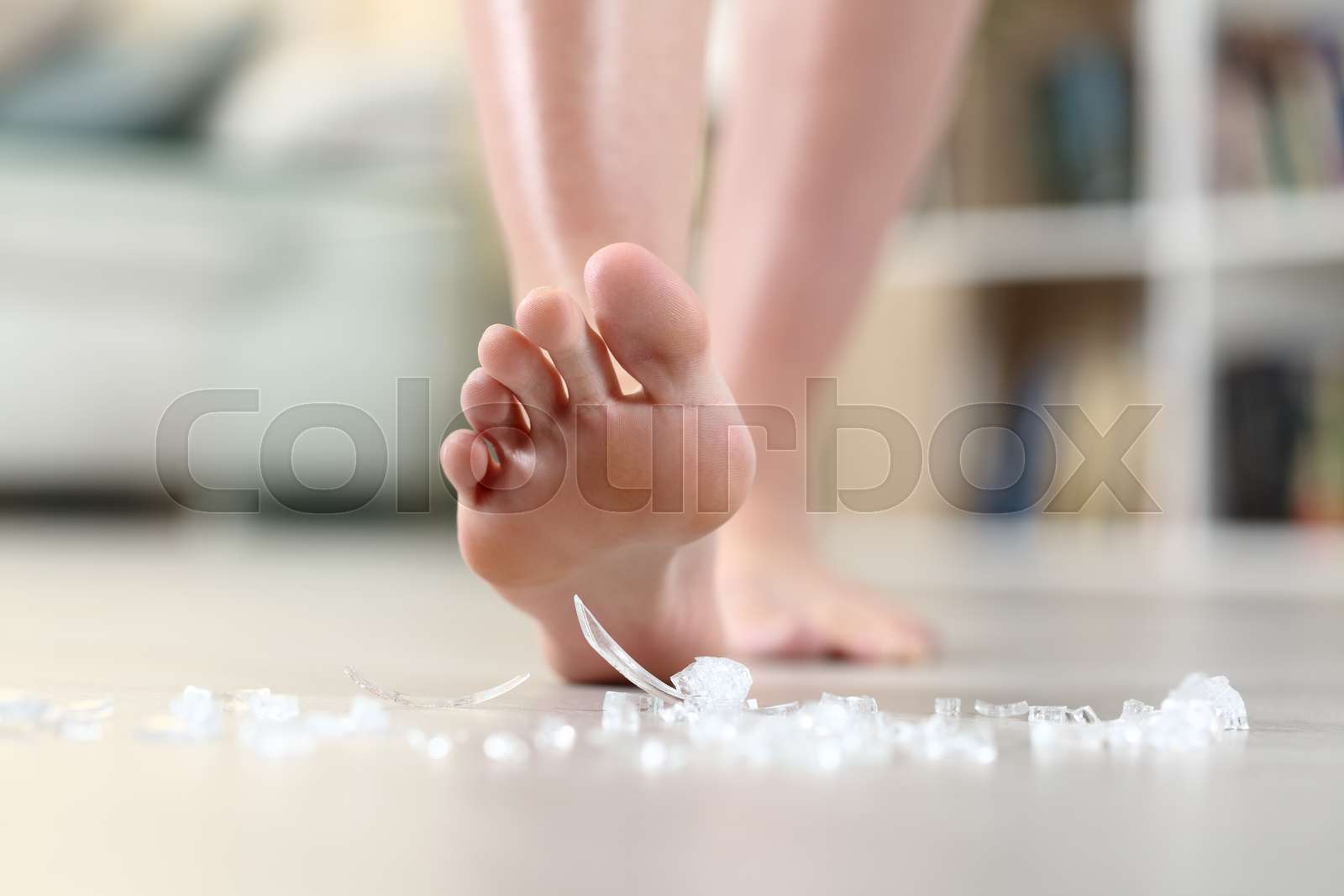 Domestic accident of woman foot stepping on broken glass | Stock image ...