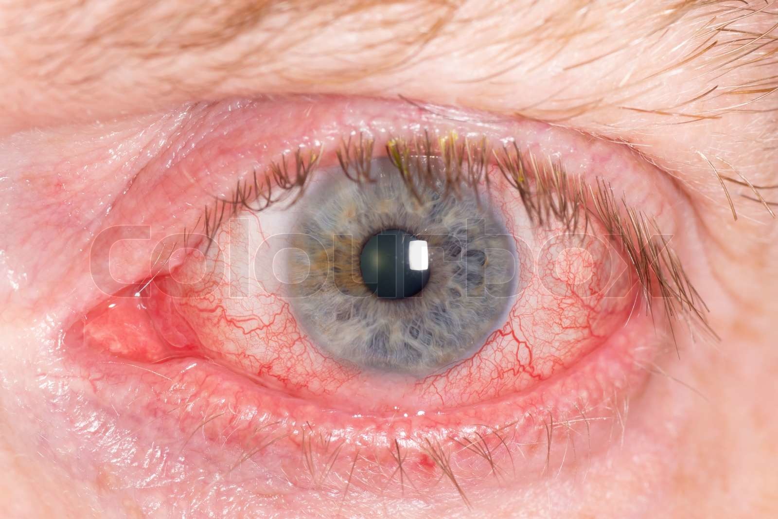 rote Auge | Stock Bild | Colourbox