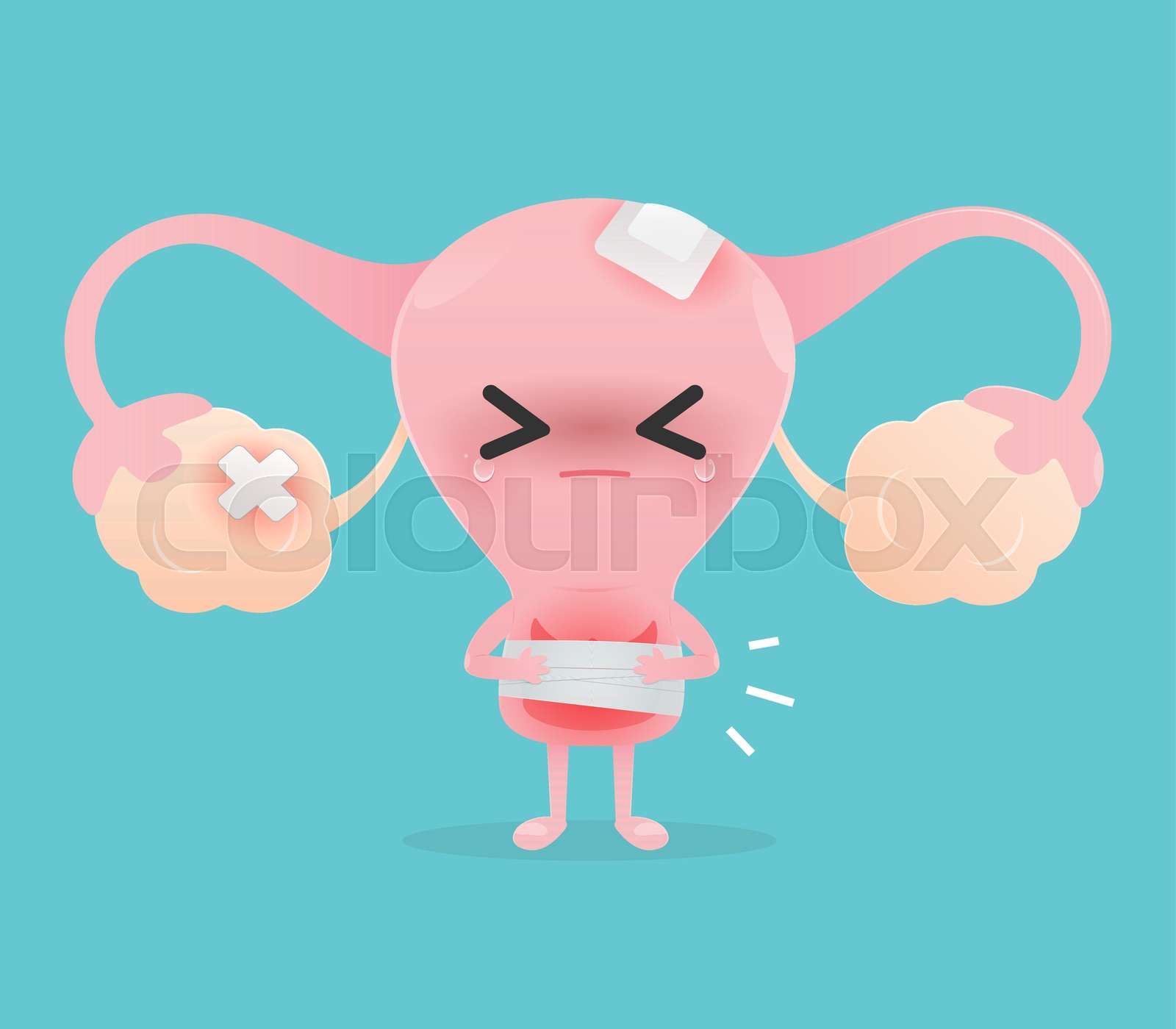 Illustration uterus inflamed ovary against a blue background. Vector ...