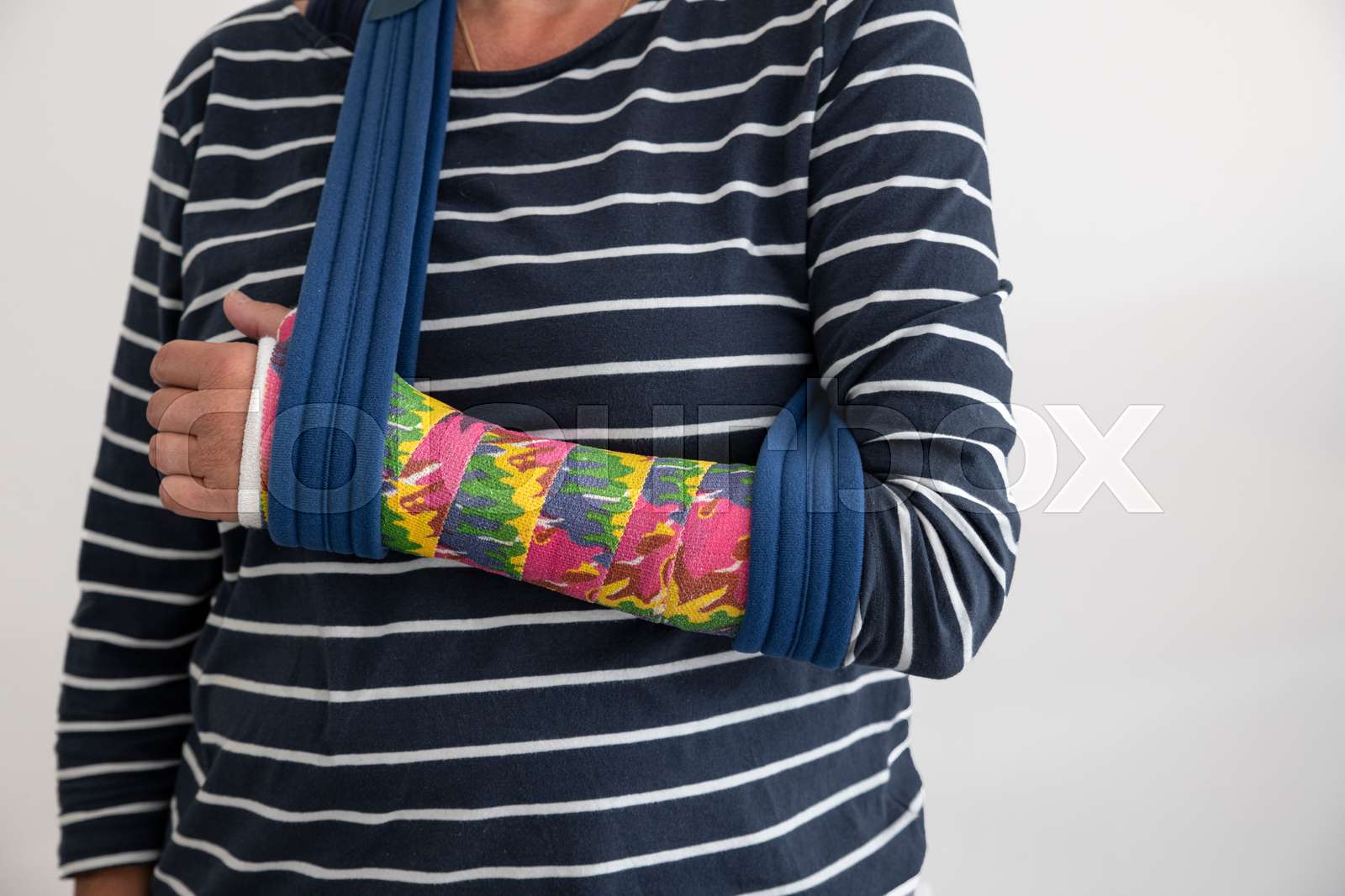 broken arm in cast and sling | Stock image | Colourbox