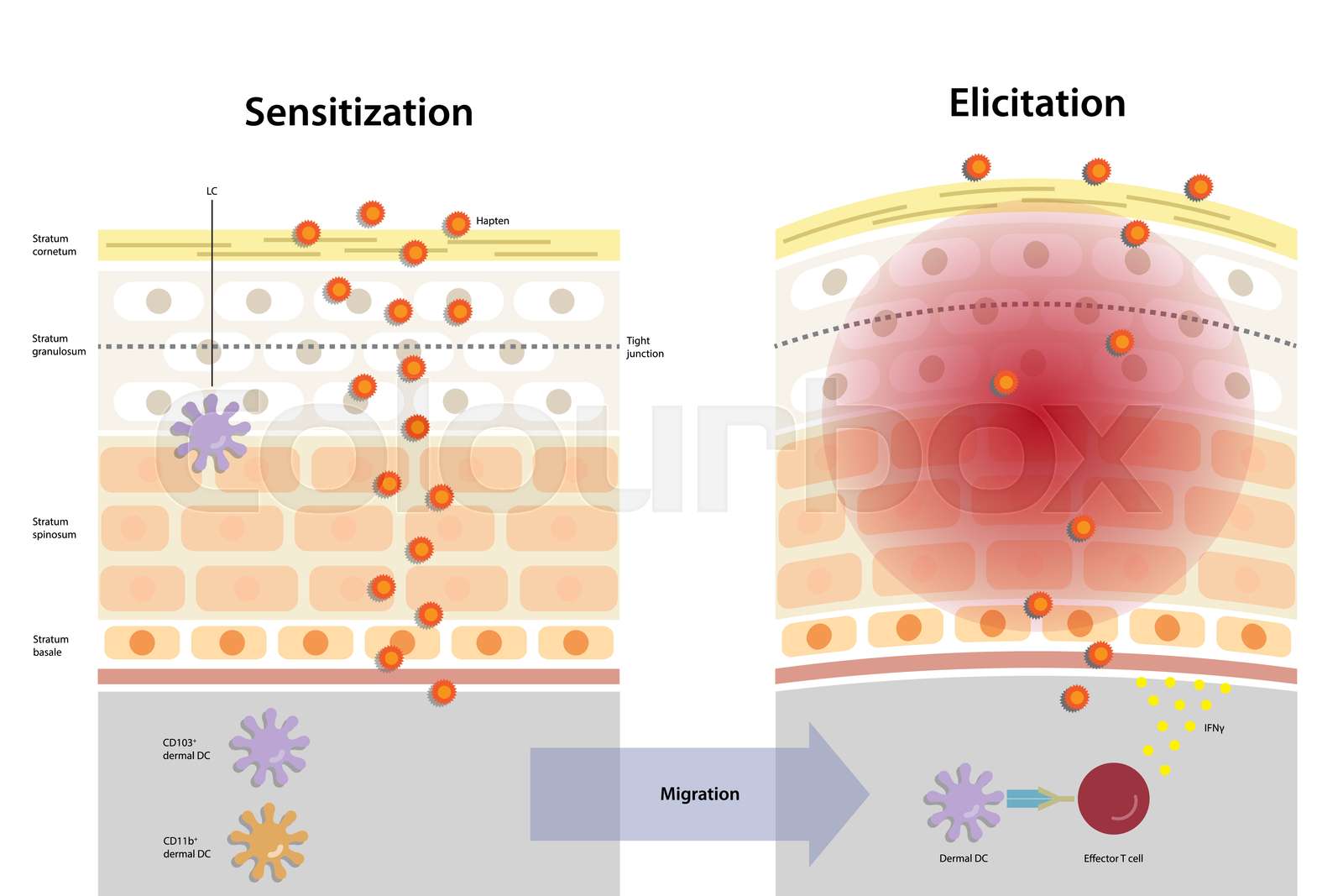 Allergen Sensitization Process Diagram Cell Microbiology Ant