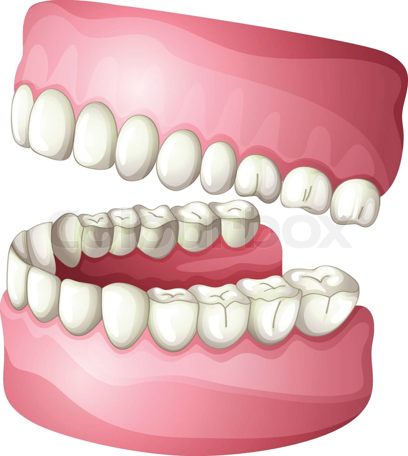 Denture | Stock vector | Colourbox