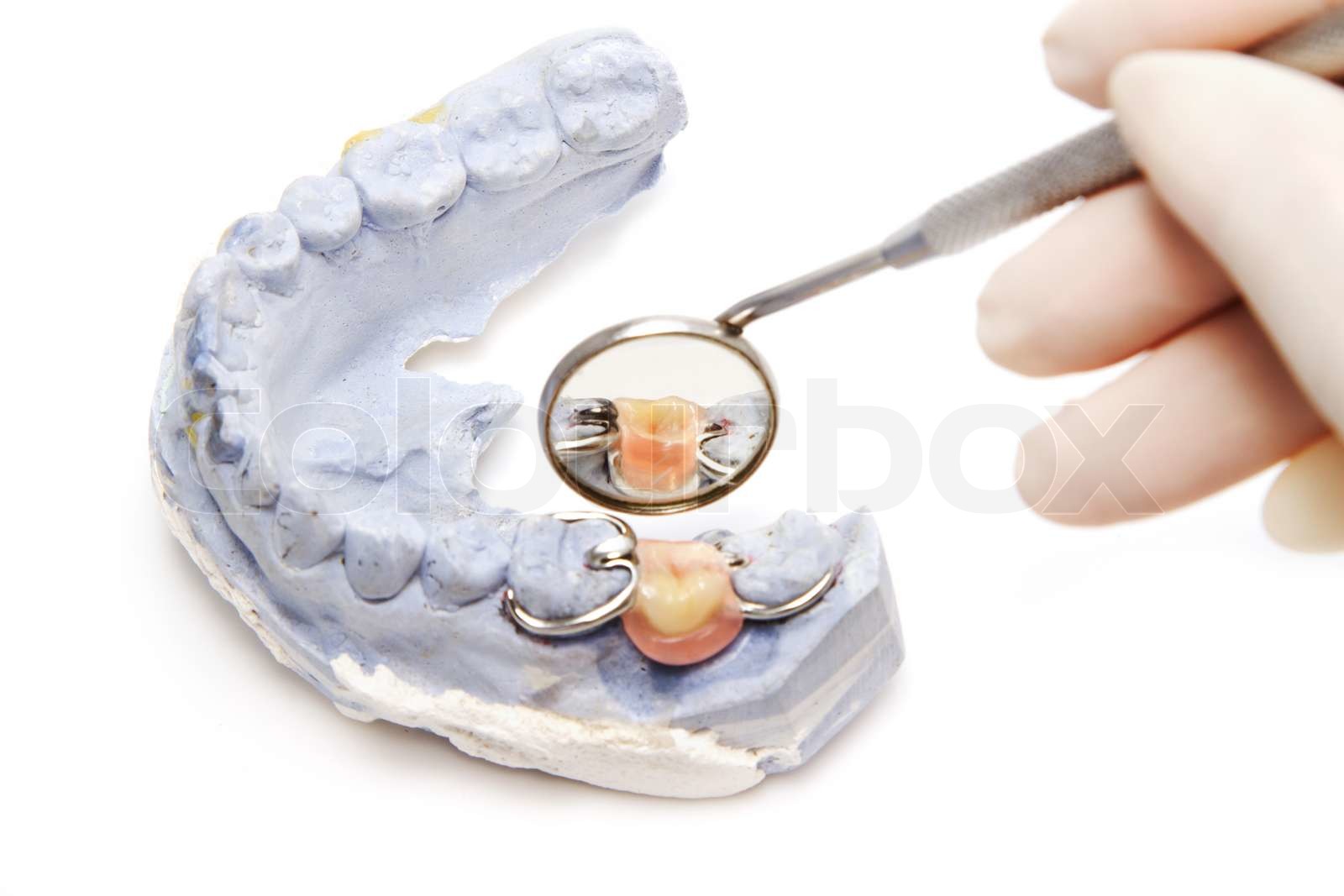 Tandprotese på gips model gips med dental værktøj | Stock foto | Colourbox
