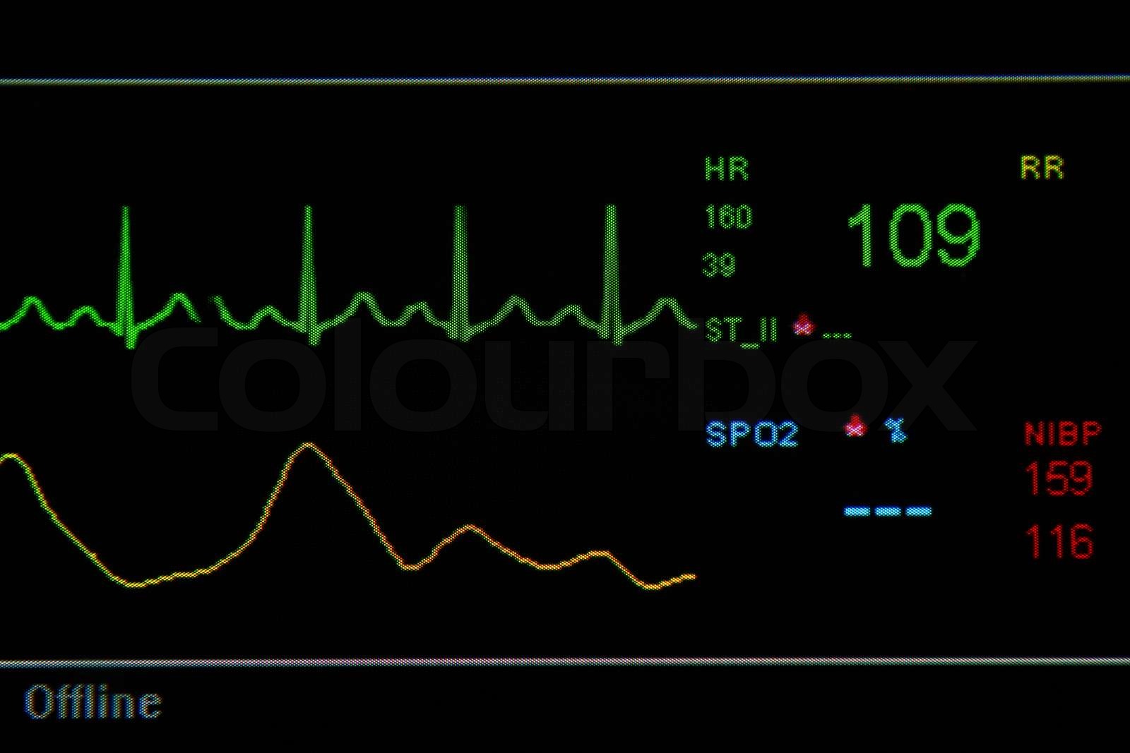 EKG monitor in ICU unit | Stock image | Colourbox