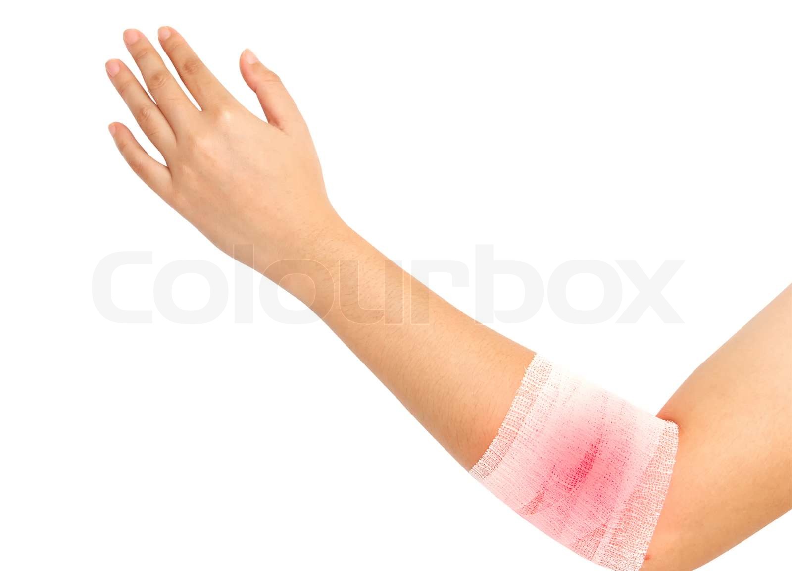 forearm and elbow injury ,strain ,sprained in white bandage on isolate ...