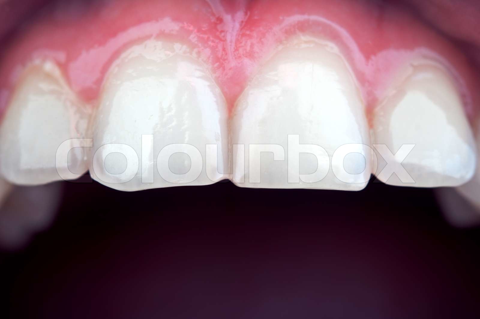 teeth background | Stock image | Colourbox