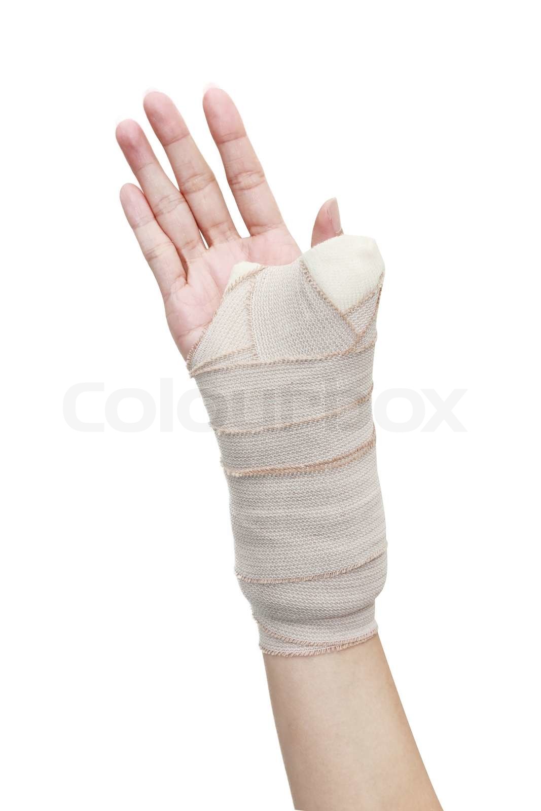 brækket kvinde arm i en cast | Stock foto | Colourbox