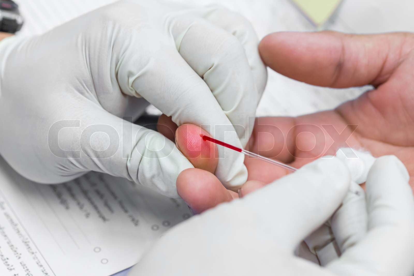 Blood testing | Stock image | Colourbox