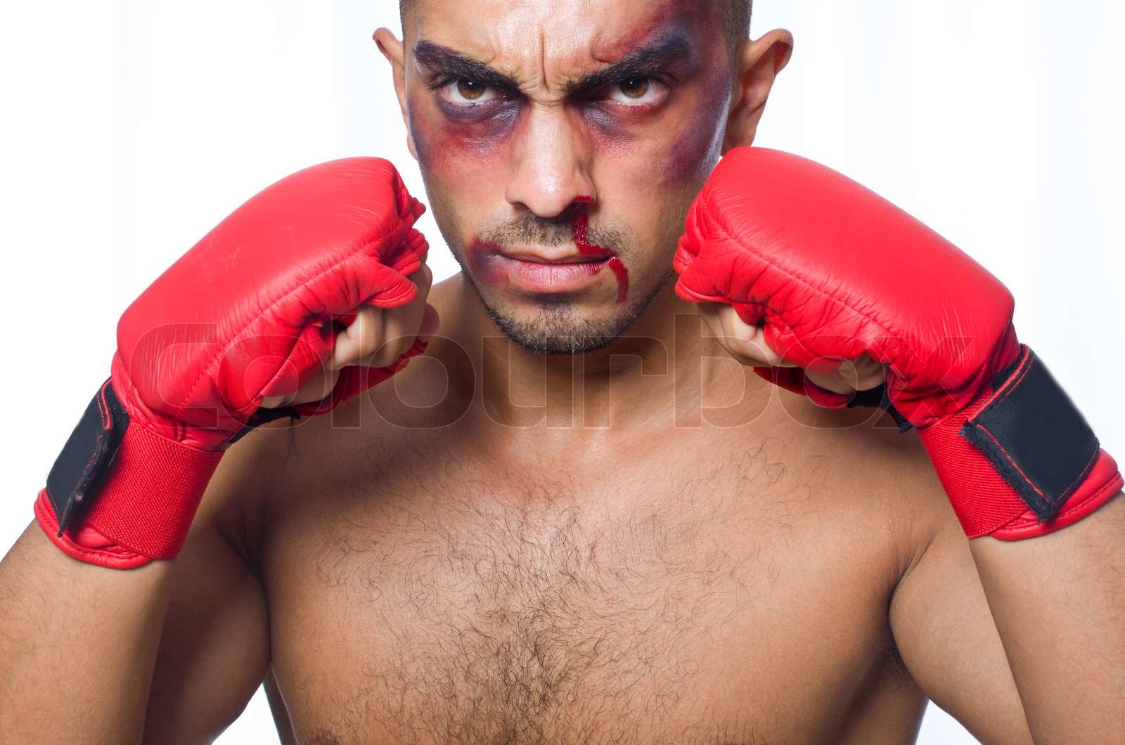 Badly beaten boxer isolated on white | Stock image | Colourbox