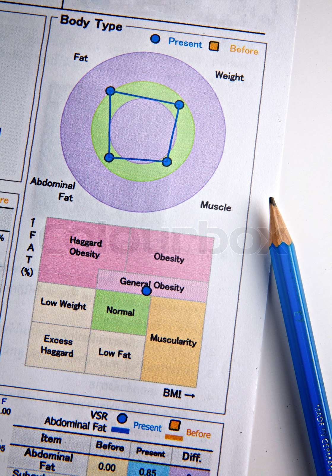 Analysis of body composition | Stock image | Colourbox