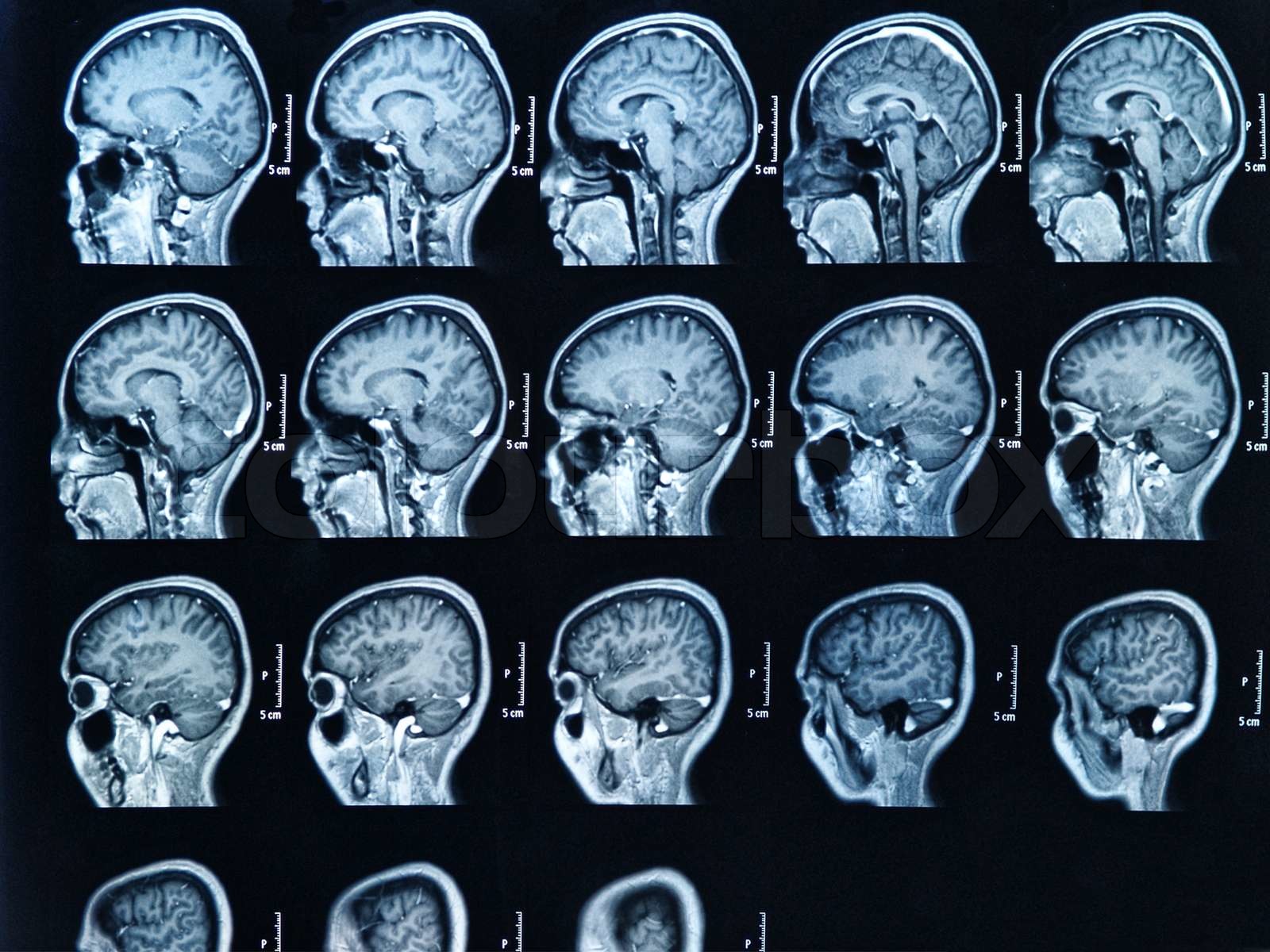 MRI Brain Scan | Stock image | Colourbox