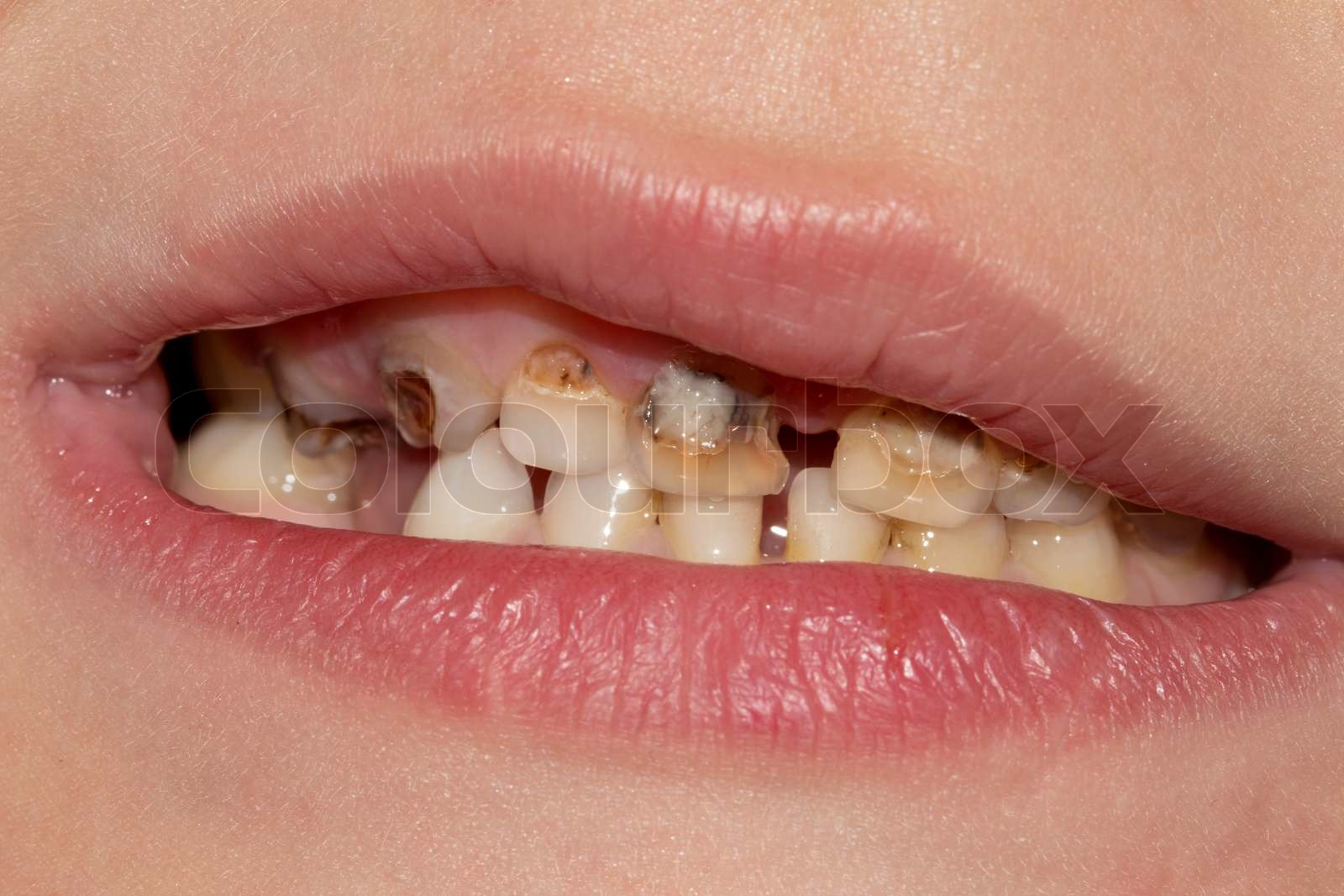 Dental Medizin und Gesundheitswesen - menschlichen Patienten Mund zeigt ...