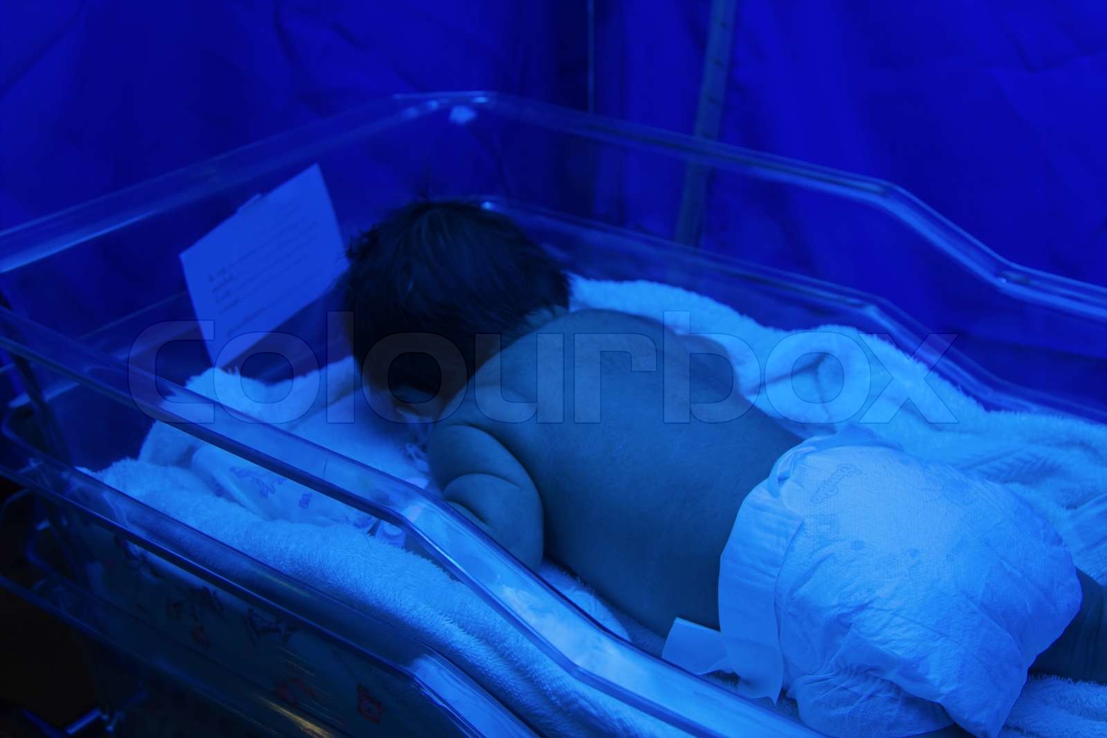 newborn baby under ultraviolet lamp in the incubator | Stock image ...