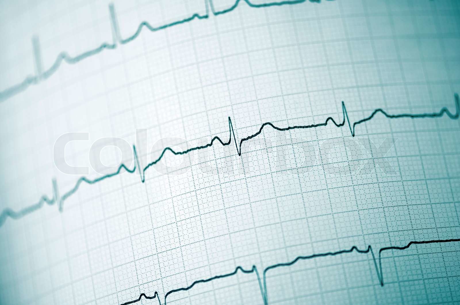 electrocardiogram | Stock image | Colourbox electrocardiogram | Stock image | Colourbox