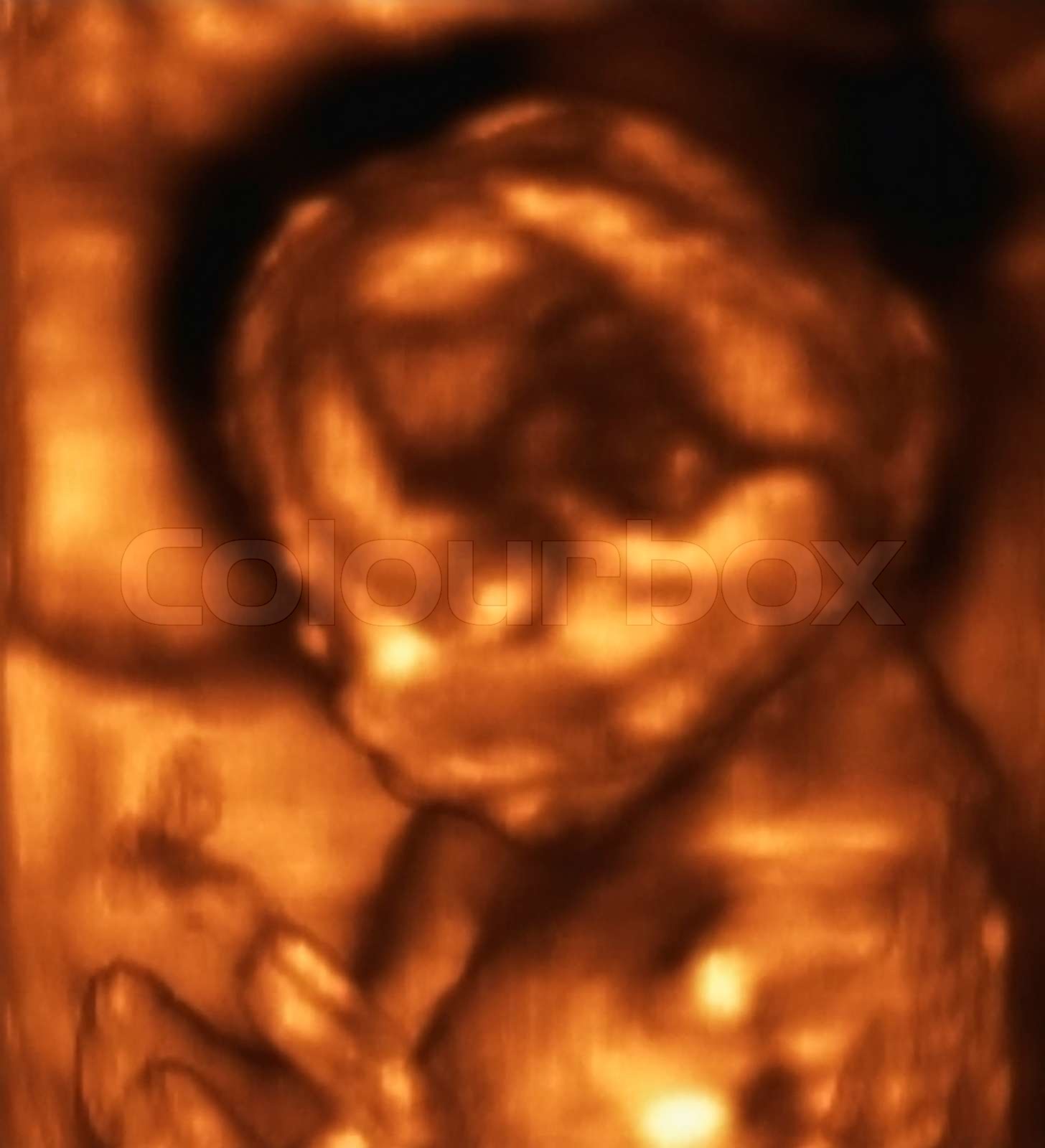 Ultrasonography Analysis of a 4th Month Fetus | Stock image | Colourbox