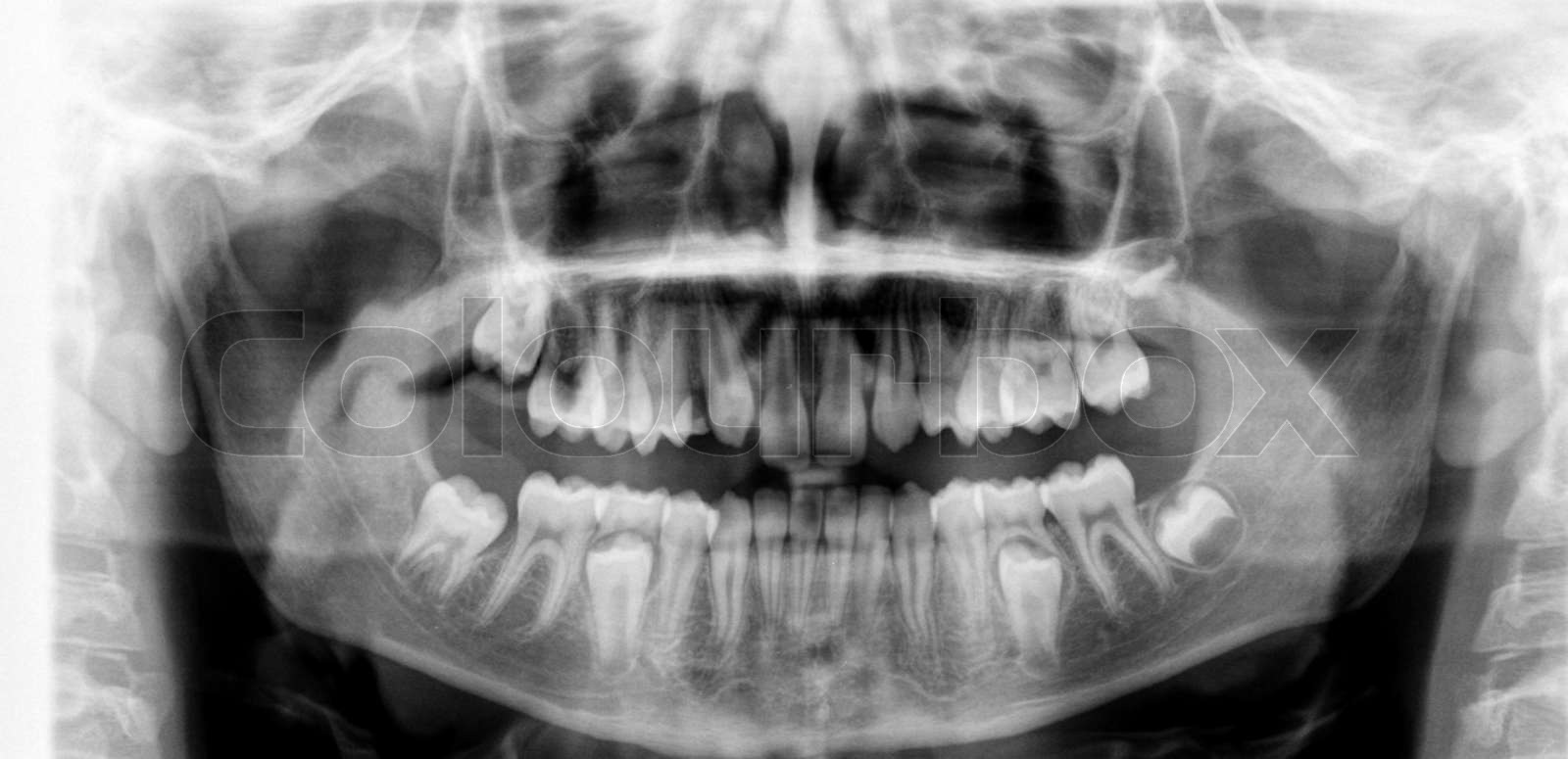 Closeup of the human skull and Teeth Dental MRI | Stock image | Colourbox