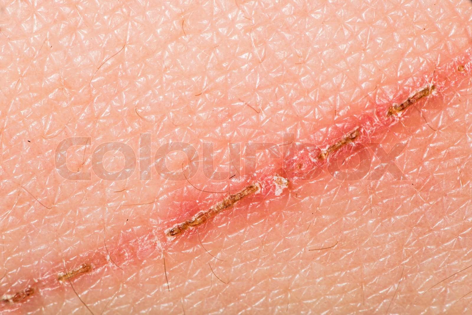 Texture of human skin and scratch | Stock image | Colourbox