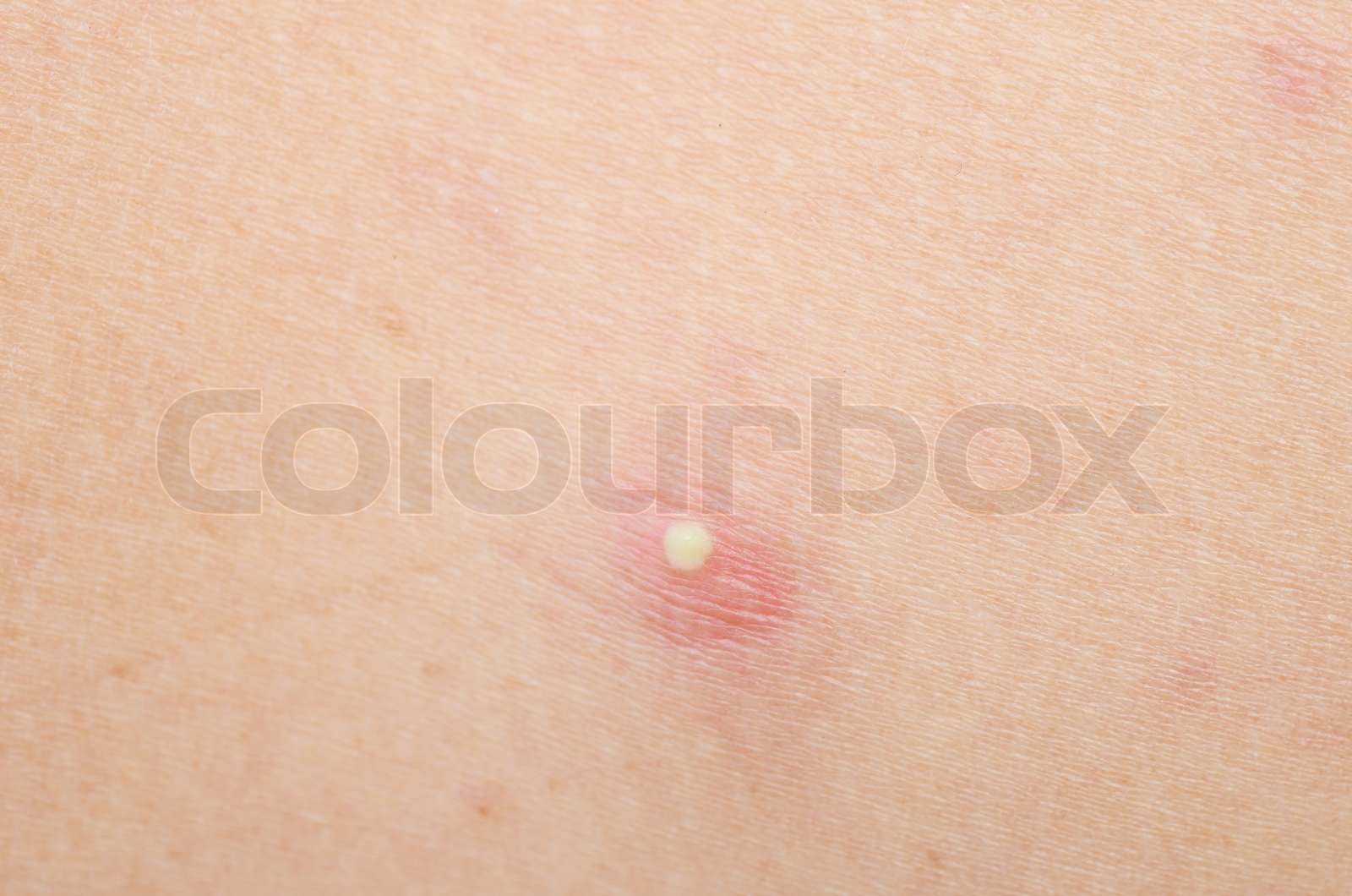 Pickel | Stock Bild | Colourbox