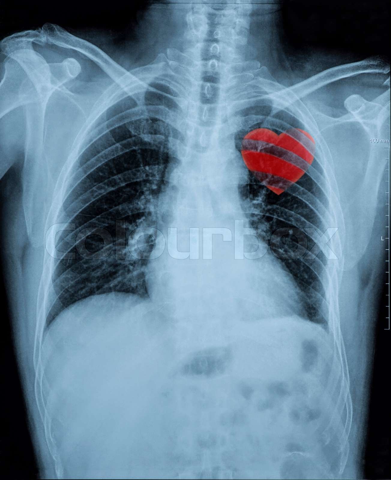 X-ray image of human breastbone with red heart shape inside | Stock ...