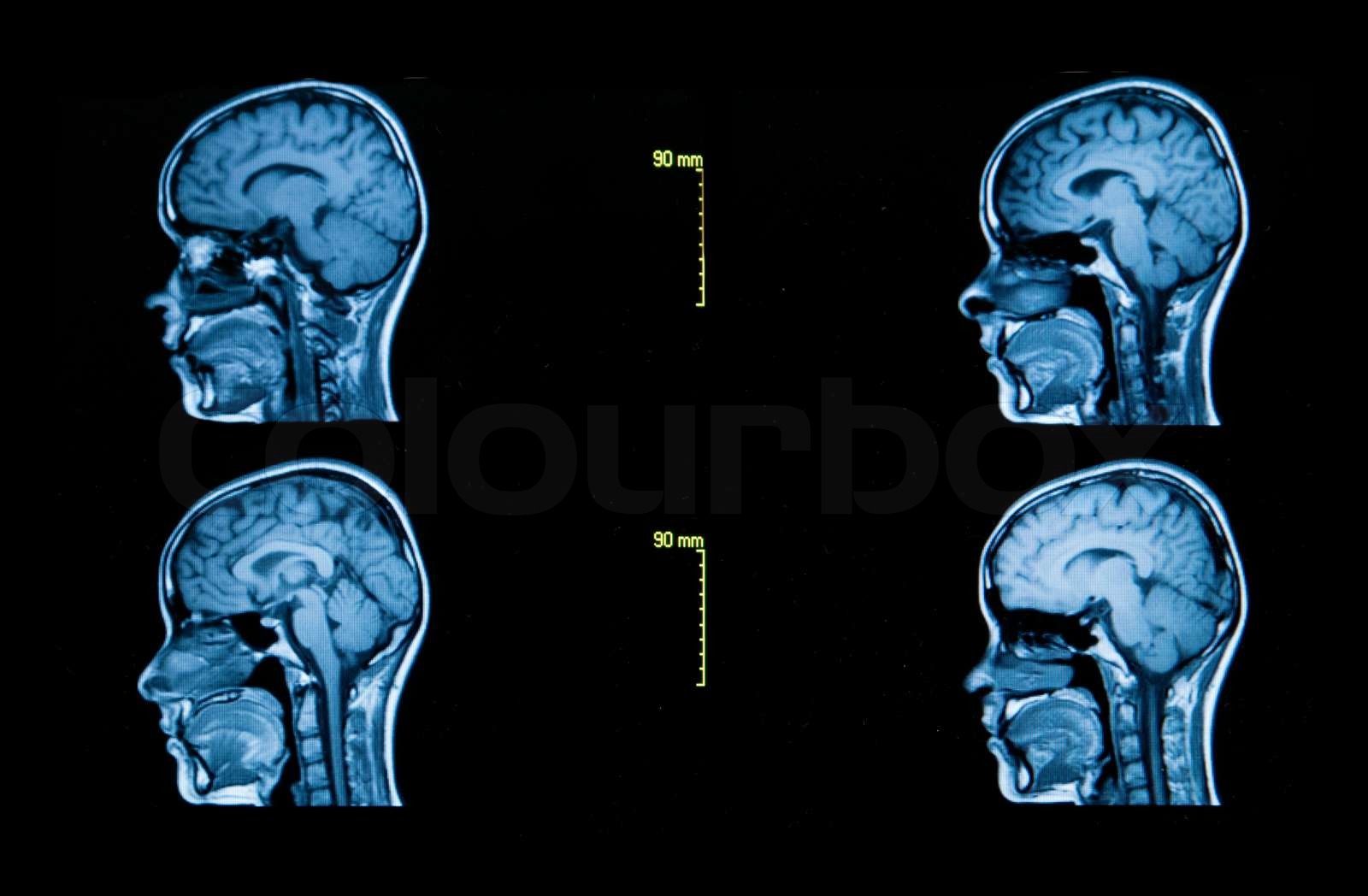 Series of images from a computerized tomography of the brain | Stock ...