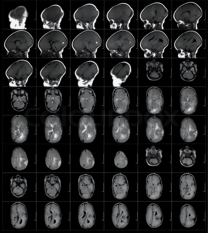 MRI human head scan | Stock image | Colourbox