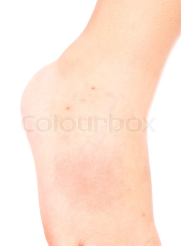 Baby Bein | Stock Bild | Colourbox