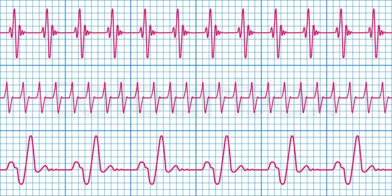 Seamless pattern of the ekg ... | Stock vector | Colourbox