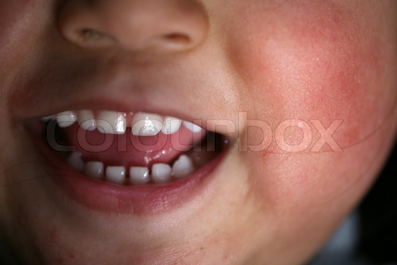 Close up of child mouth while laughing | Stock Photo | Colourbox