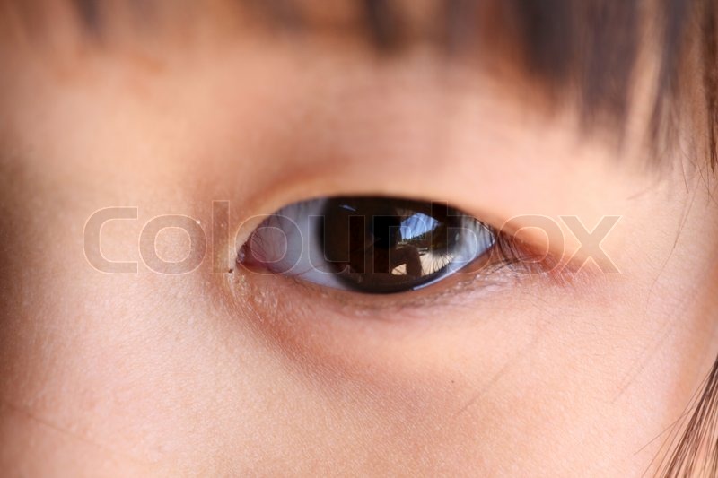 Chinese Smiling Eyes