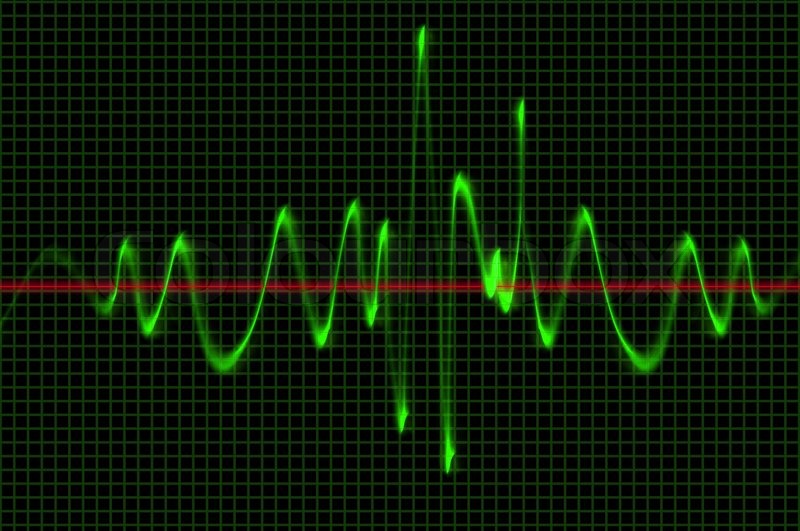 Ringing Oscilloscope Patterns