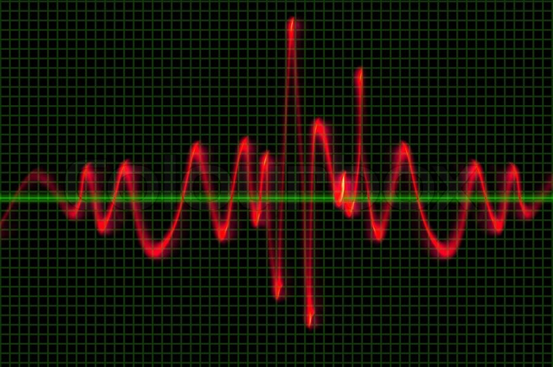 Ringing Oscilloscope Patterns