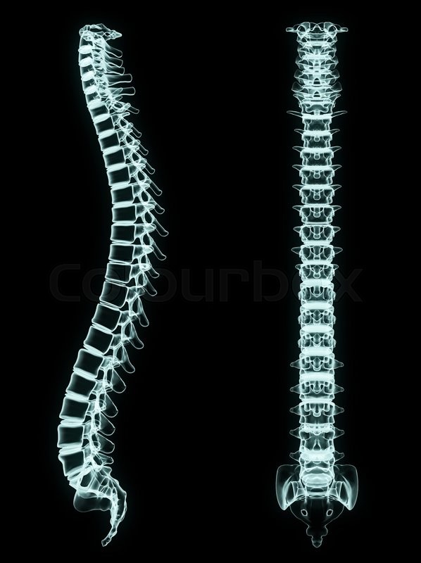 X-ray spine front and side in ... | Stock image | Colourbox
