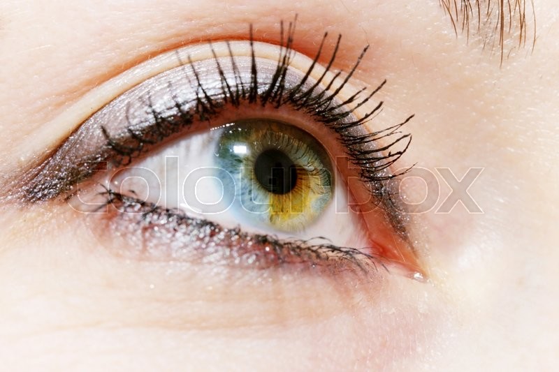 Female eye with a birthmark on the iris | Stock image | Colourbox