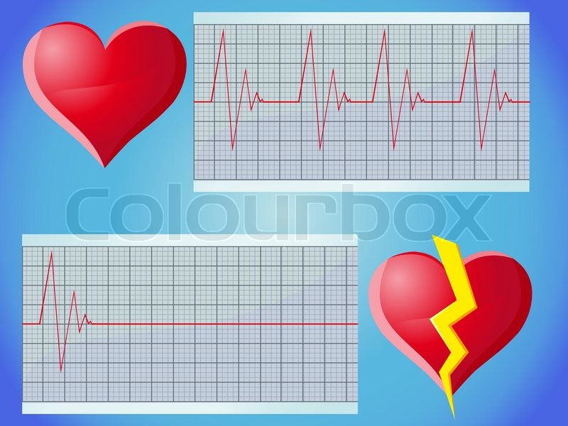 Herzfrequenz Puls Vektor-Illustration | Stock-Vektor | Colourbox