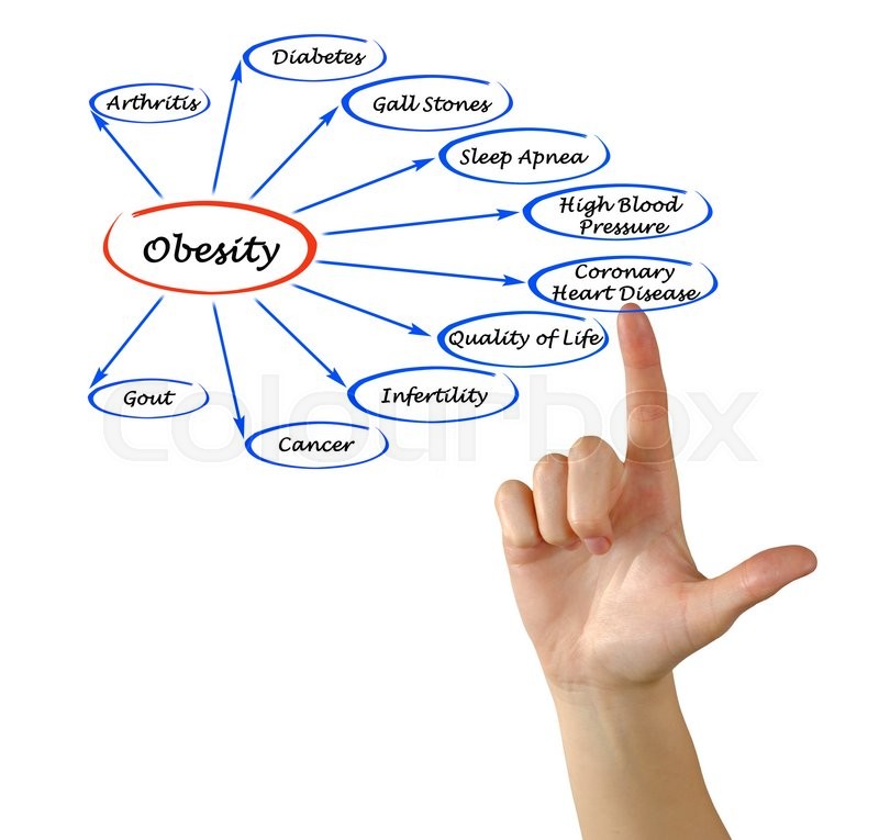 Diagram of Obesity | Stock image | Colourbox