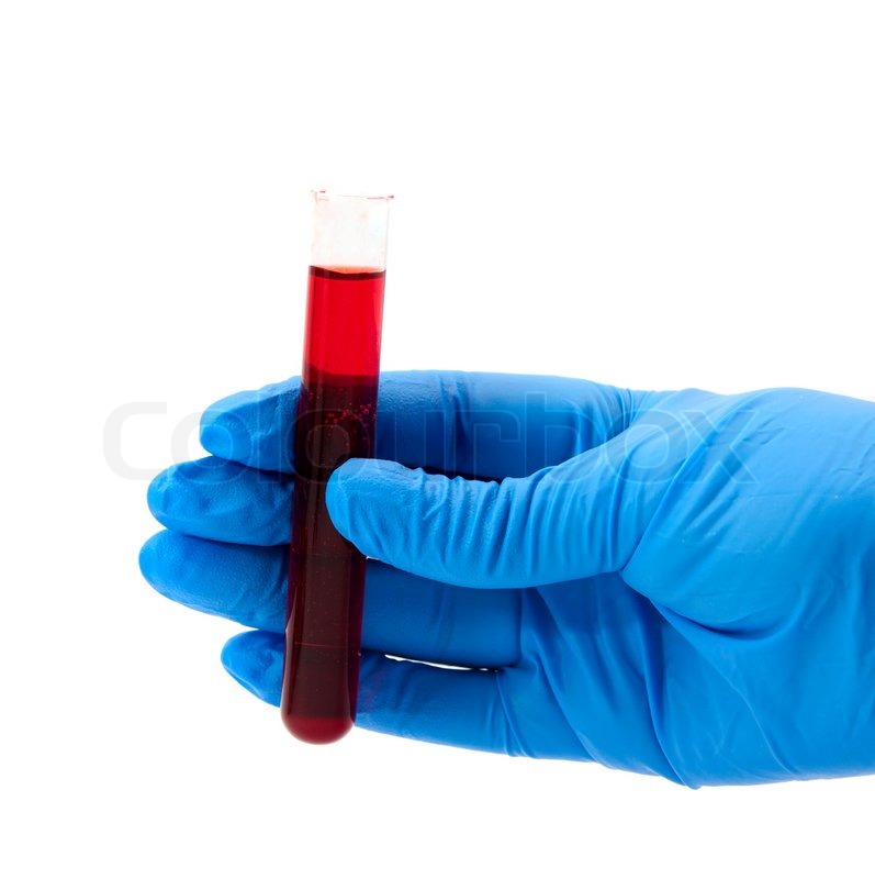Vial of blood in his hand on a white ... | Stock image | Colourbox