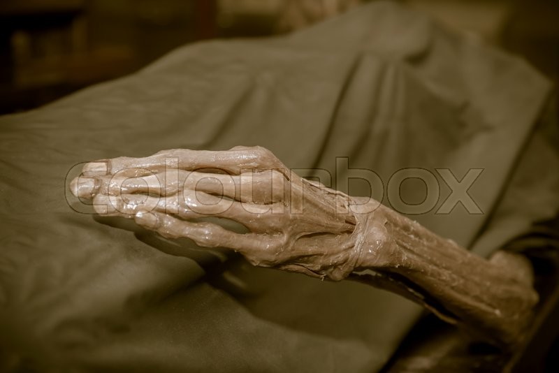 The dead body, Focus on hand decay. | Stock image | Colourbox