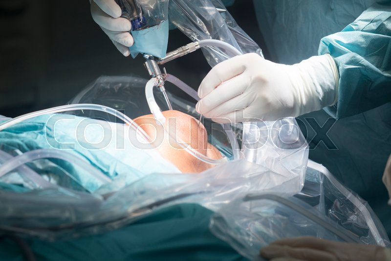 Knee keyhole surgery hospital ... | Stock image | Colourbox