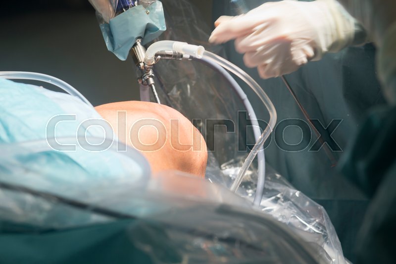 Knee keyhole surgery hospital ... | Stock image | Colourbox