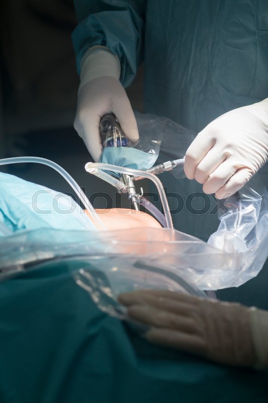 Knee keyhole surgery hospital ... | Stock image | Colourbox