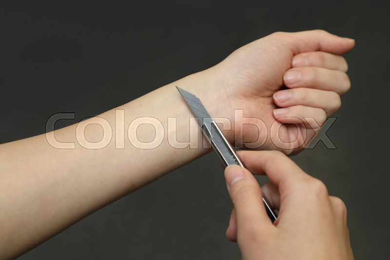 Wrist Cuts Pictures