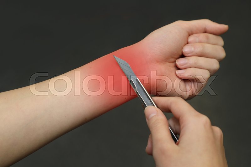 Wrist Cut By Blade
