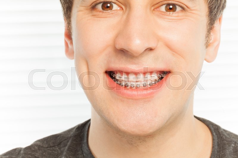 Happy Smiley Faces With Braces