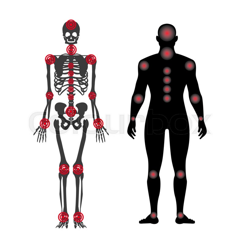 Human body with area of pain | Stock vector | Colourbox