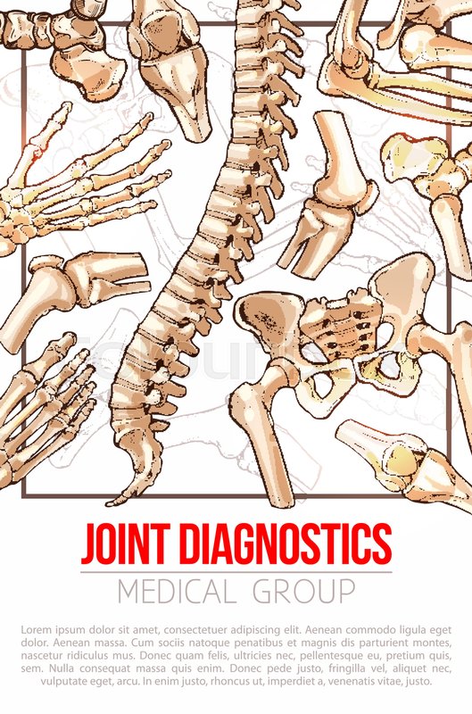 Joints diagnostics medical poster for ... | Stock vector | Colourbox